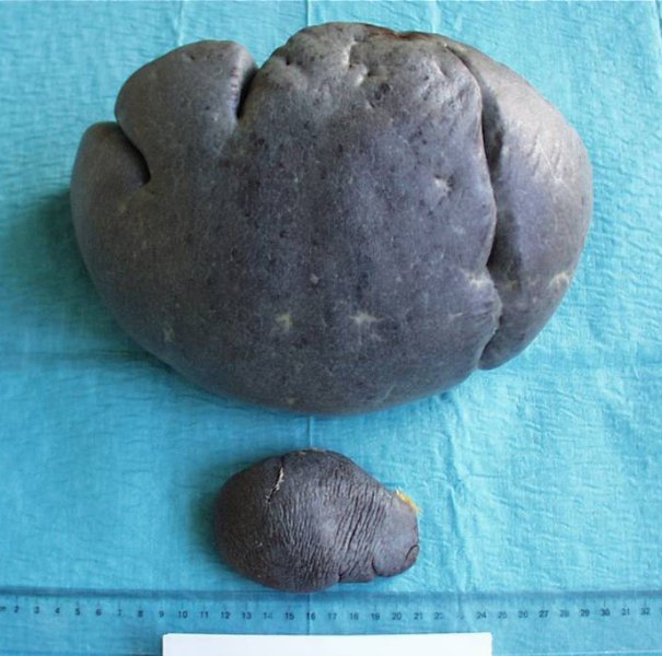 Laboratorij za virtualnu mikroskopiju - Slika 2. Povećana slezena (mikro)