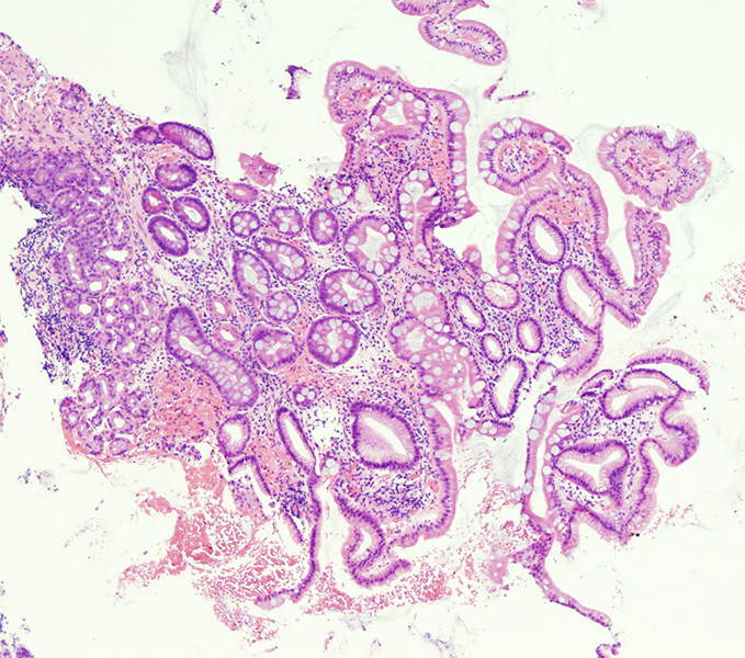 Laboratorij za virtualnu mikroskopiju - Slika 3. Intestinalna ...